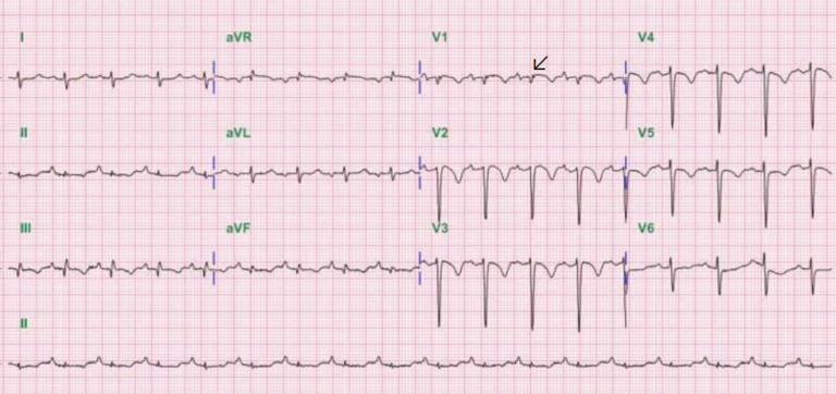 ECG Case 1 - Ruey J. Sung - rsung.org